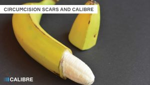Circumcision scars: Does it complicate your penis augmentation?